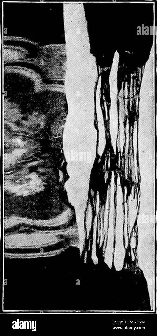 . Study of fabrics. Original Residue Weighted Silks Before axd After ...