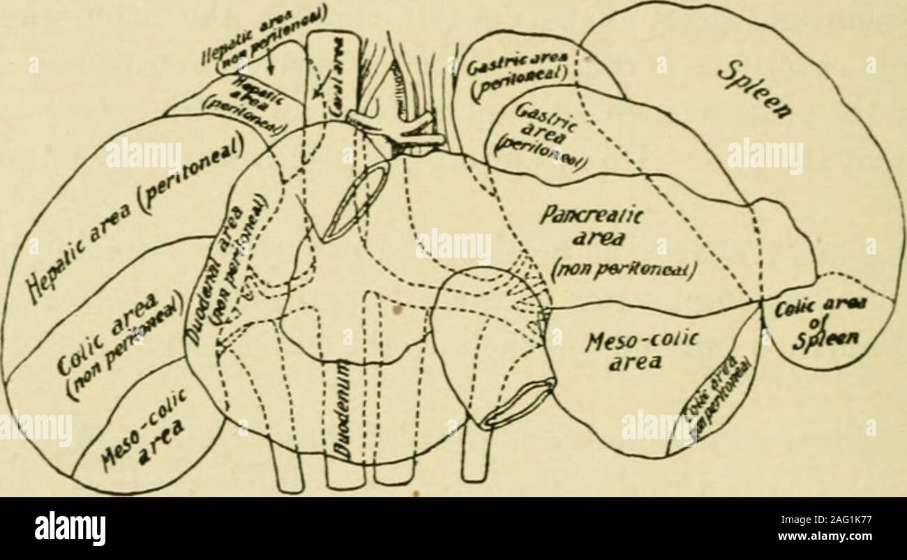 . Manual of operative surgery. e course of transperitoneal operations ...