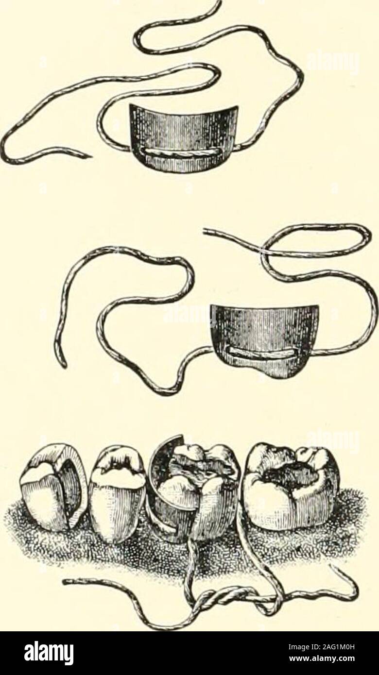 . The science and practice of dental surgery. 356 and the ligature ...