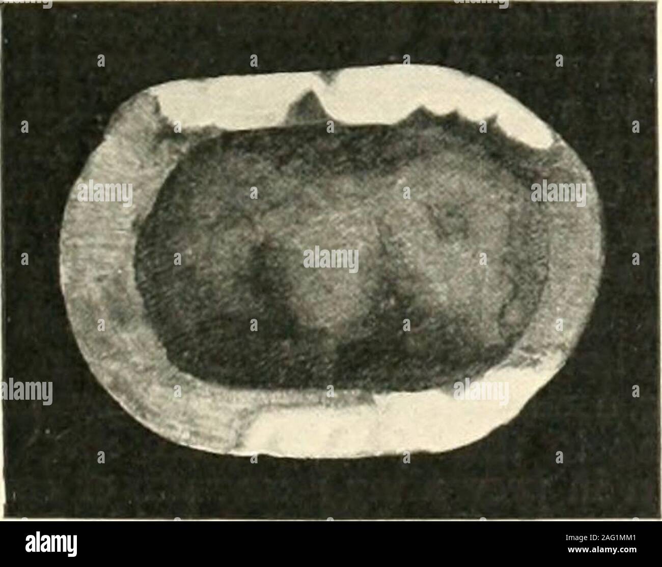 . The science and practice of dental surgery. KiG. 427.—Diagram showing ...