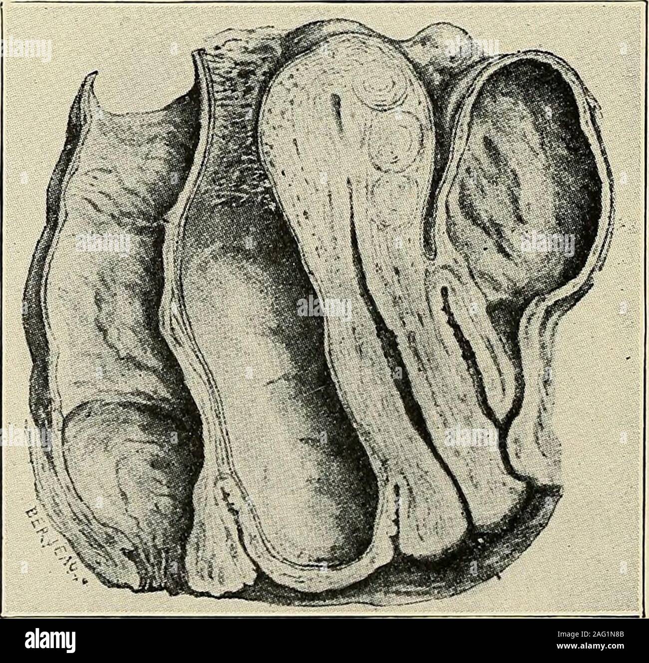 . The diagnosis and treatment of diseases of women. Fig. 301 ...