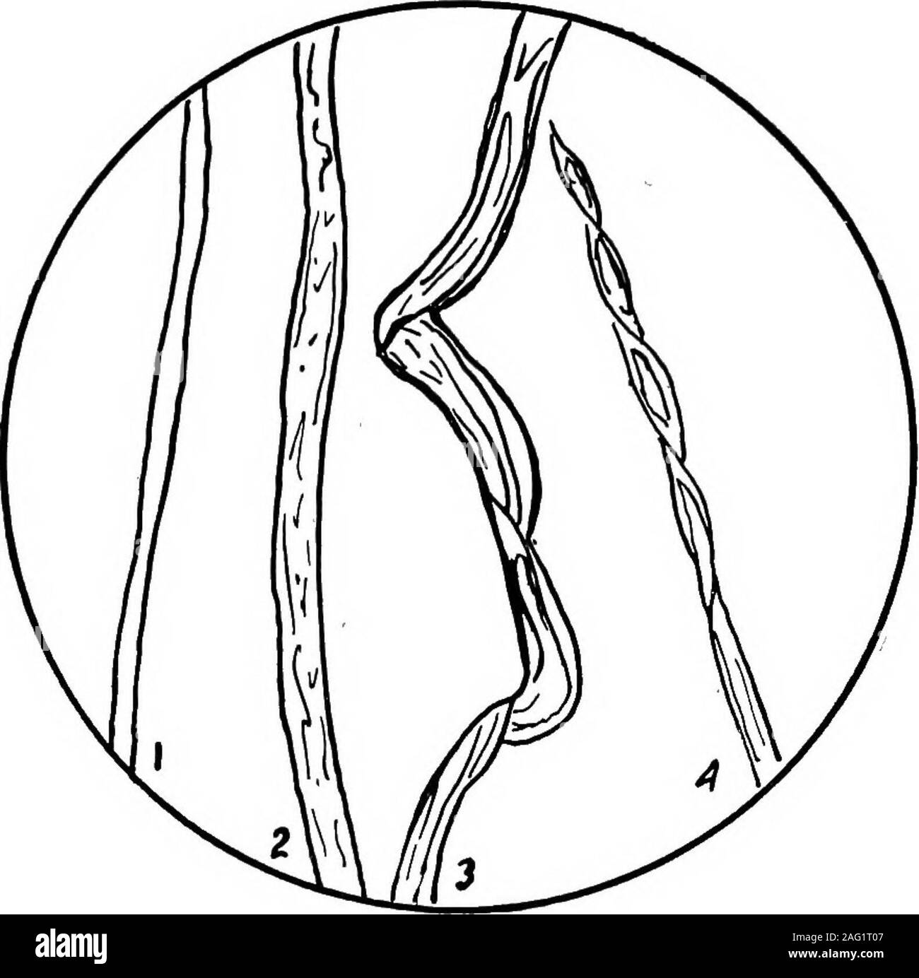 Starch luster hi-res stock photography and images - Alamy