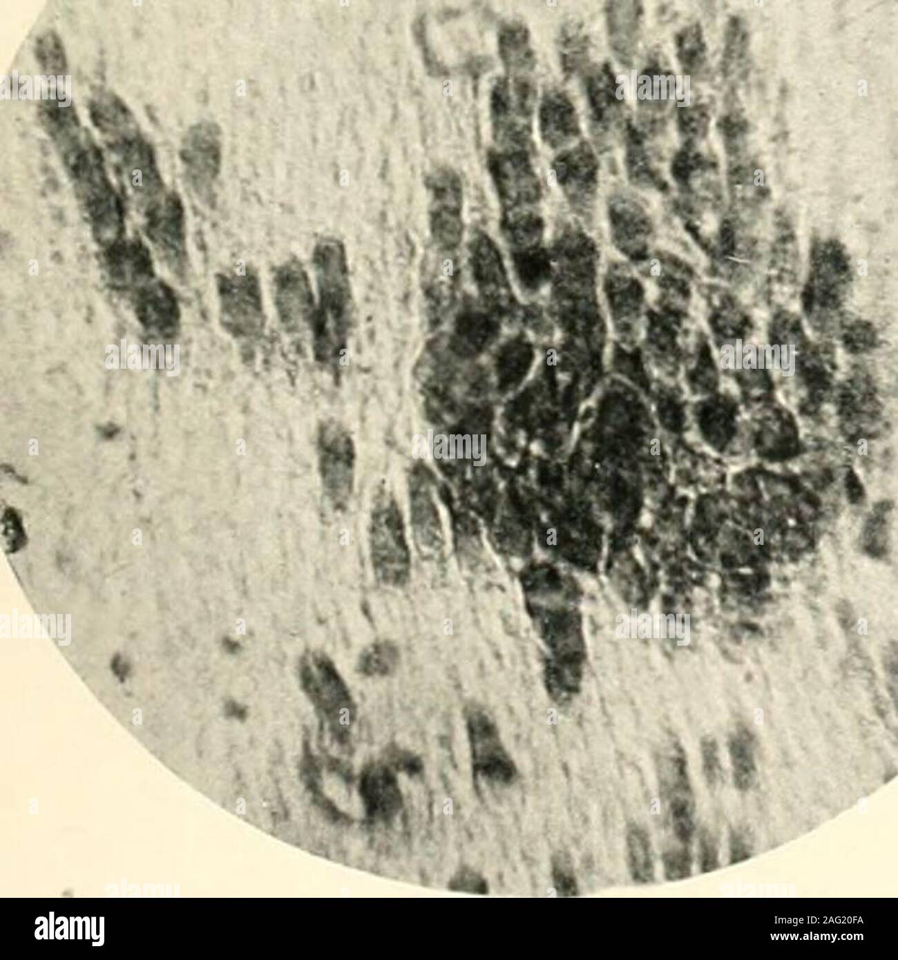 . The science and practice of dental surgery. Fig. 390.—A late stage of ...