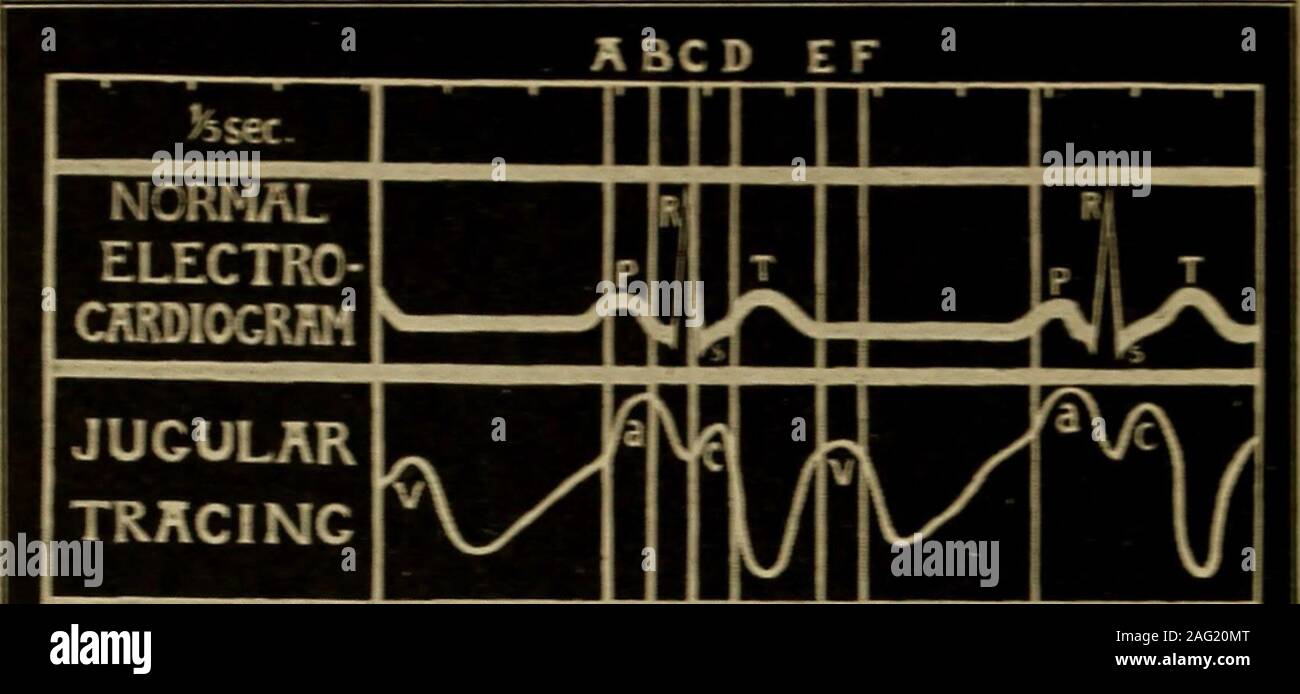 Pulsation cycle hi-res stock photography and images - Alamy