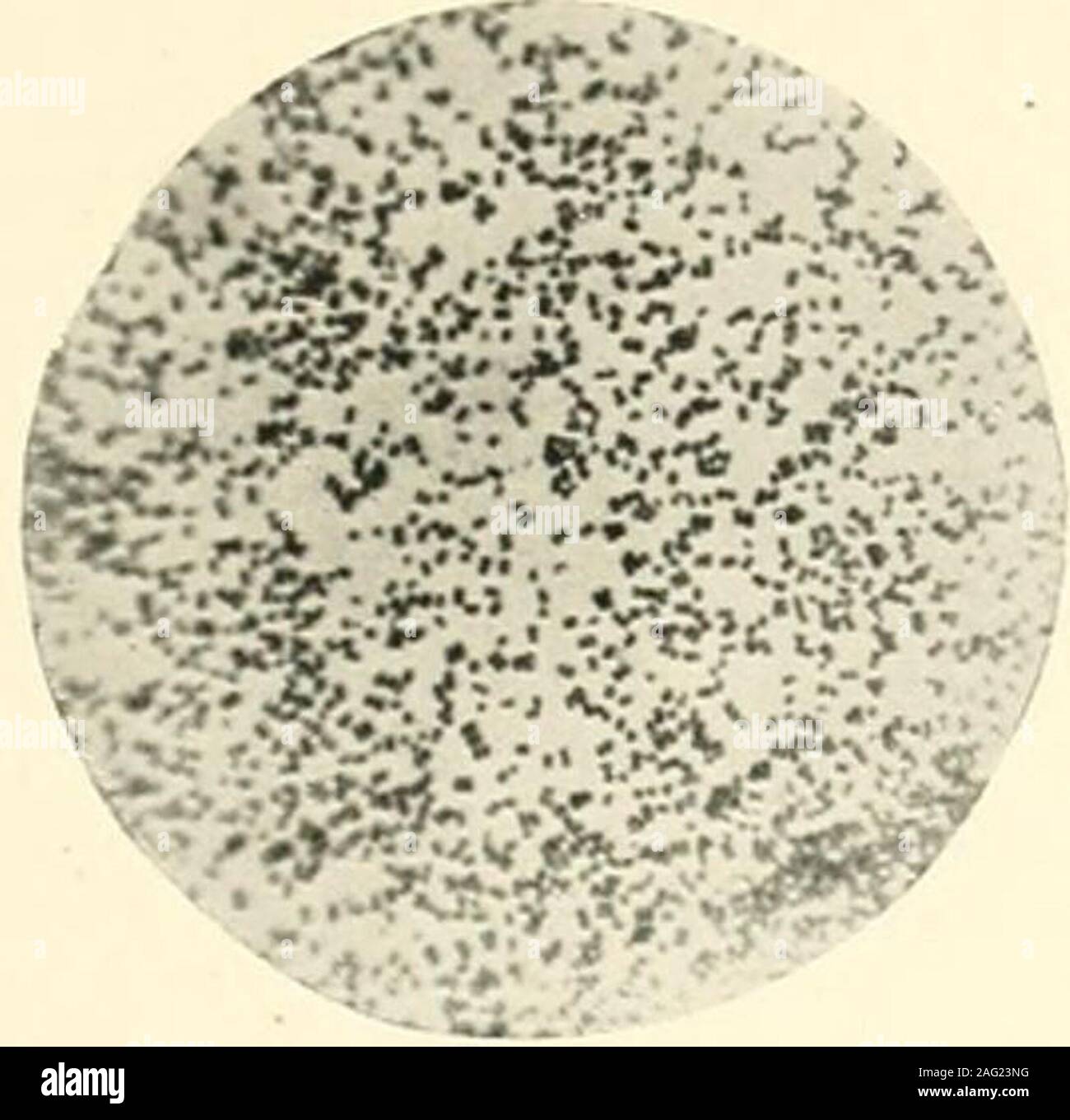 Tetanus bacillus hi-res stock photography and images - Alamy