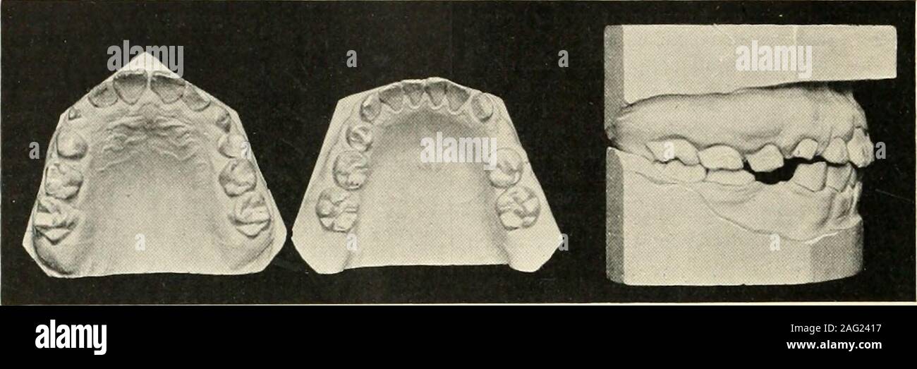 Tend dental hi-res stock photography and images - Alamy