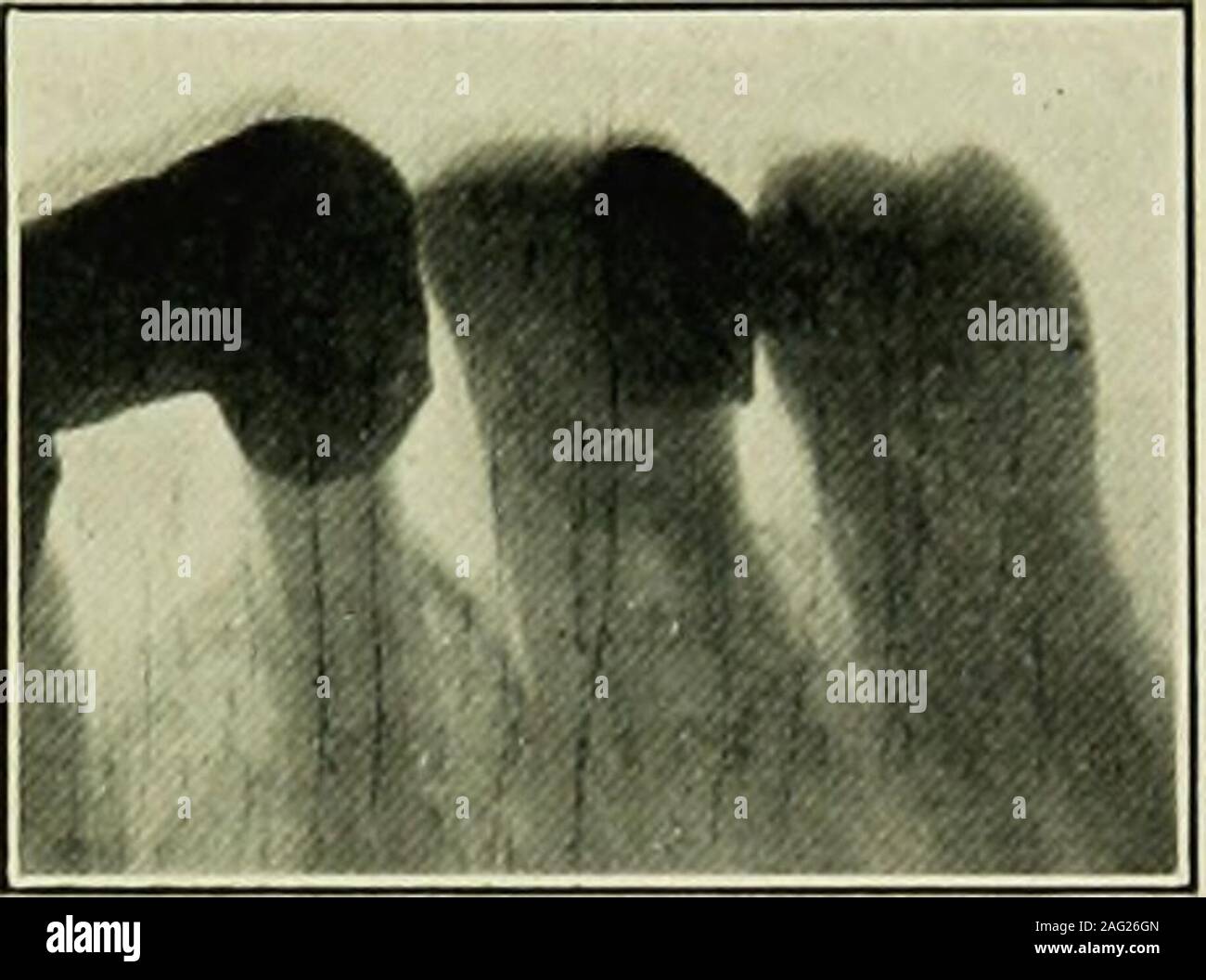 Bony socket hi-res stock photography and images - Alamy