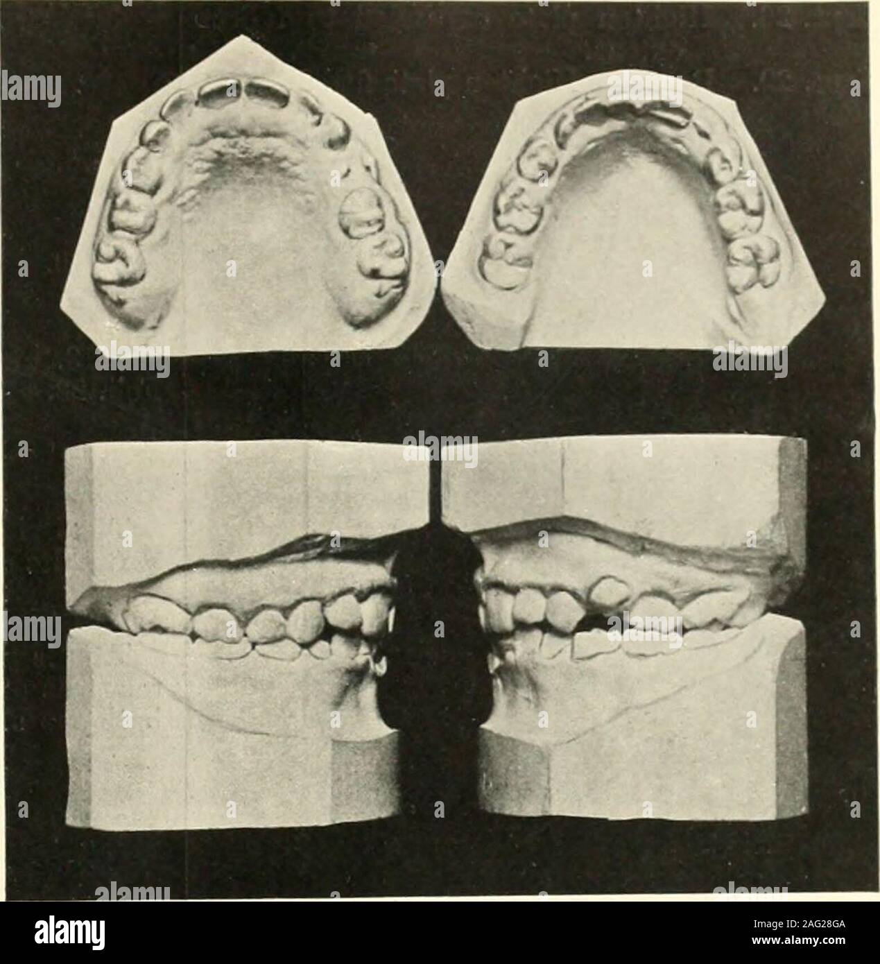 Labial surgery hi-res stock photography and images - Alamy