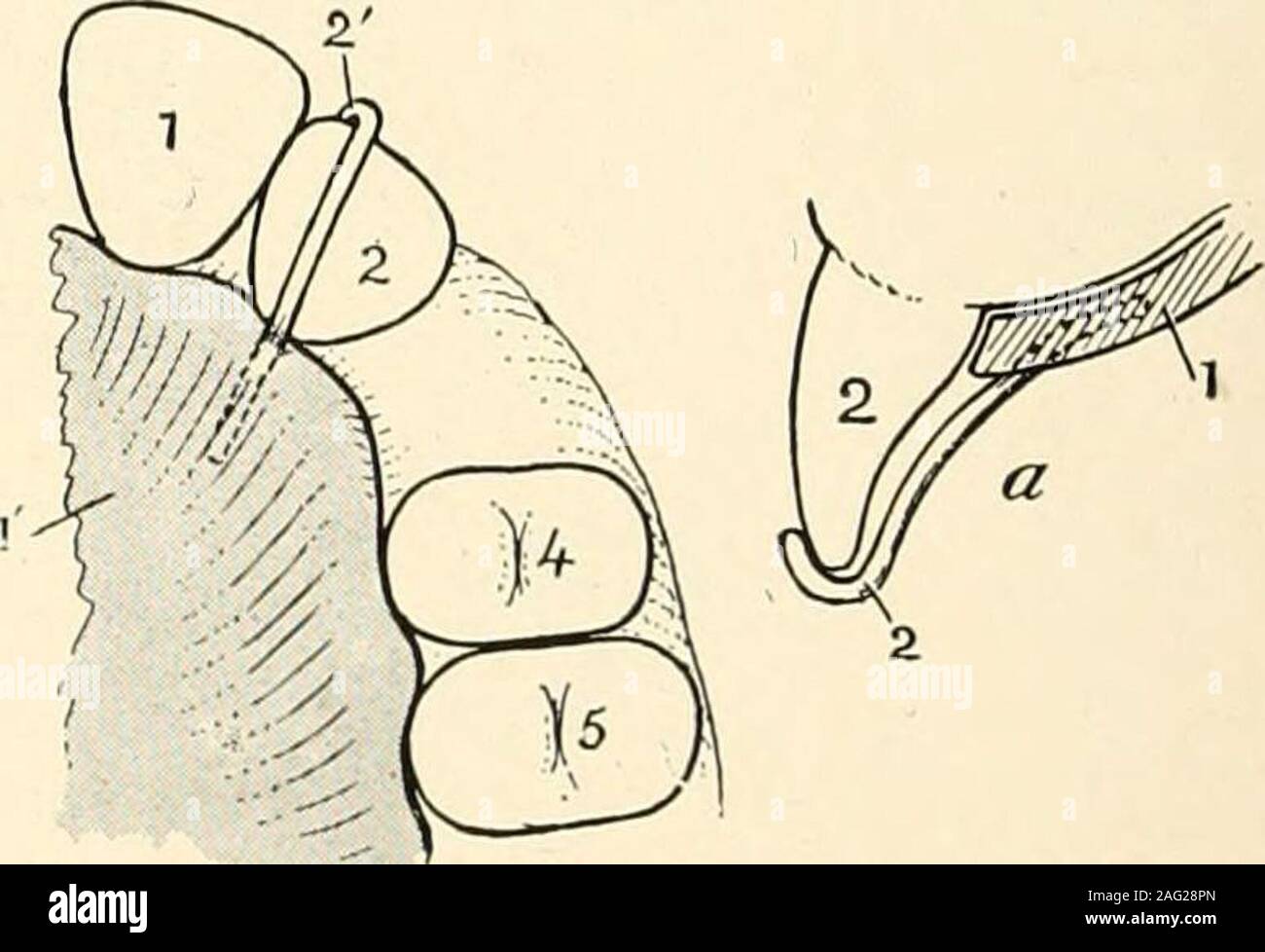 Labial wire hi-res stock photography and images - Alamy