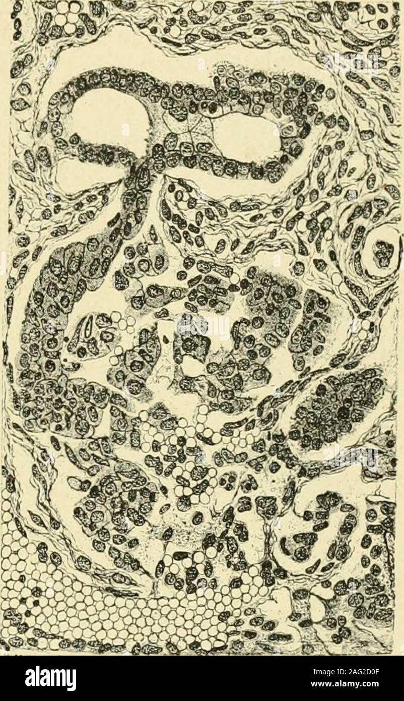 Acinus pancreas hi-res stock photography and images - Alamy