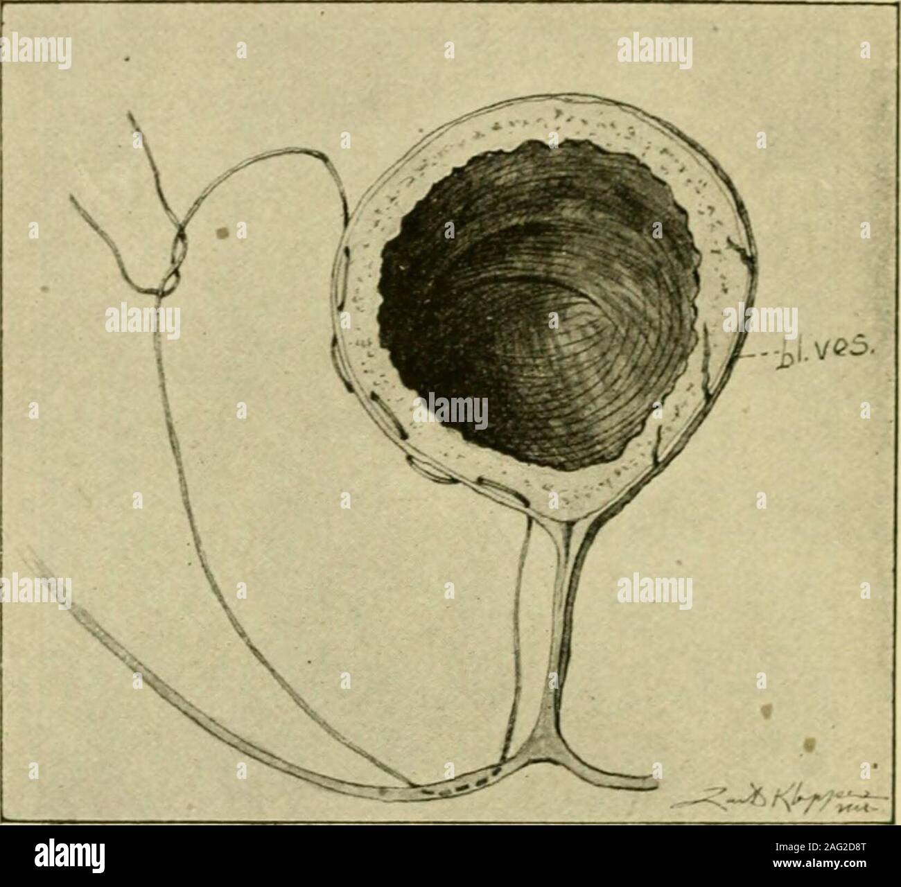 . Manual of operative surgery. on of the psoas parvus muscle, or if ...