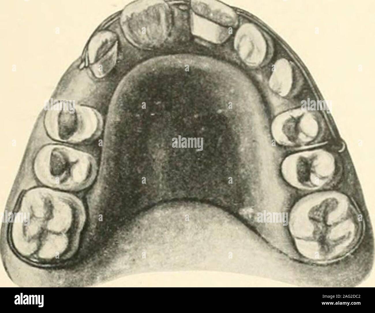 Cingulum Tooth