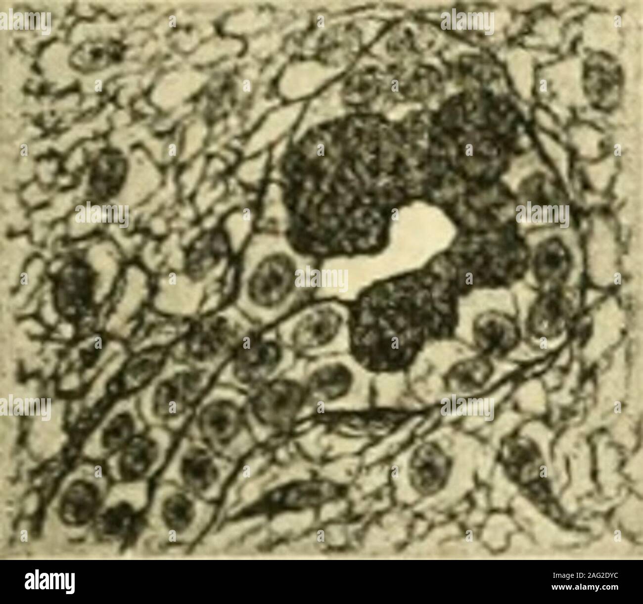 Alveolar ducts hi-res stock photography and images - Alamy