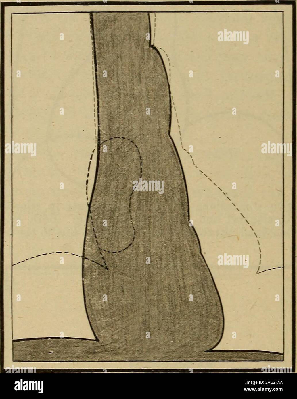 Ptotic hi-res stock photography and images - Alamy