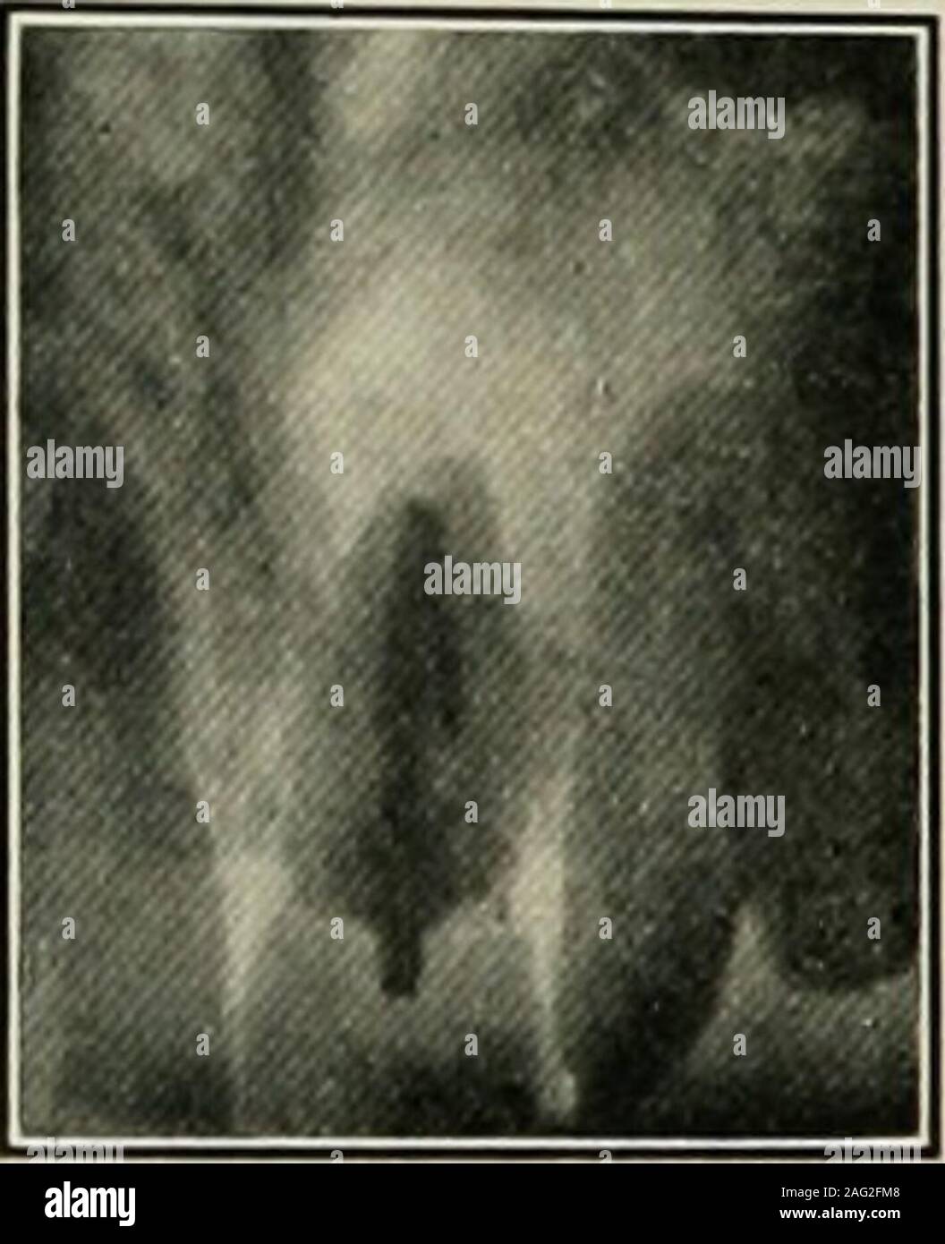 Theoperation hi-res stock photography and images - Alamy