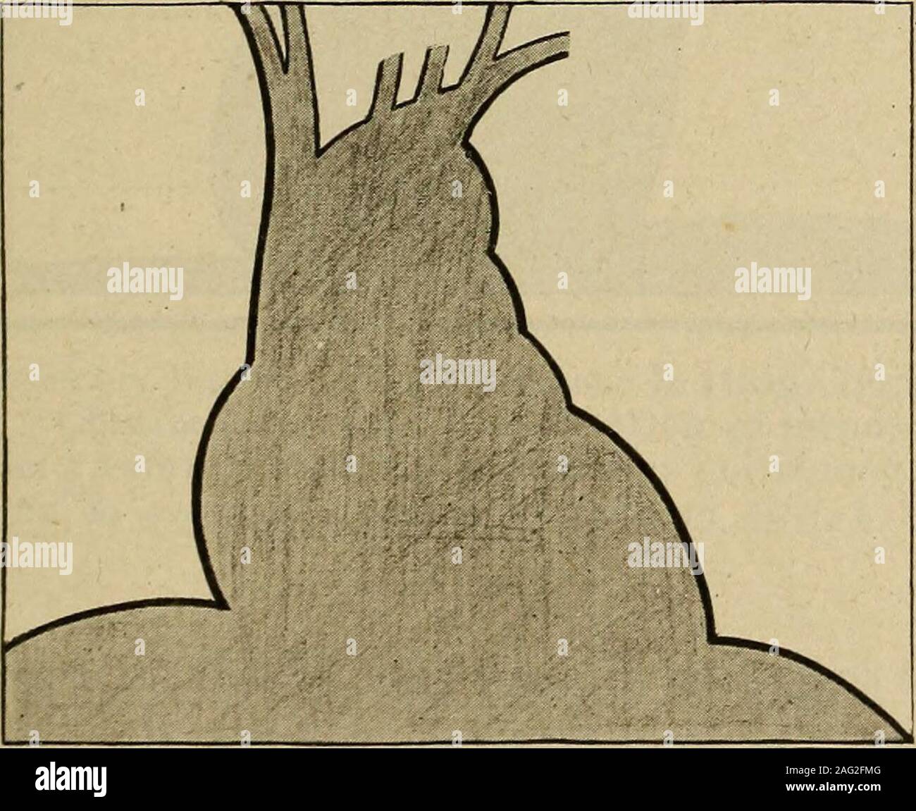 . Medical diagnosis for the student and practitioner. Fig. 156.—The two ...