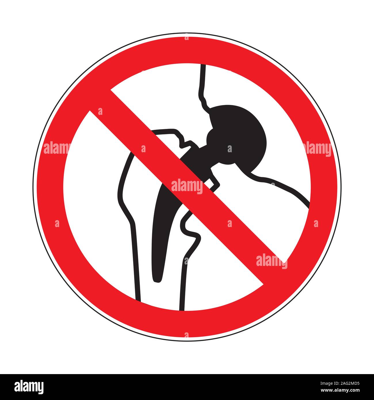 No metallic implants hi-res stock photography and images - Alamy