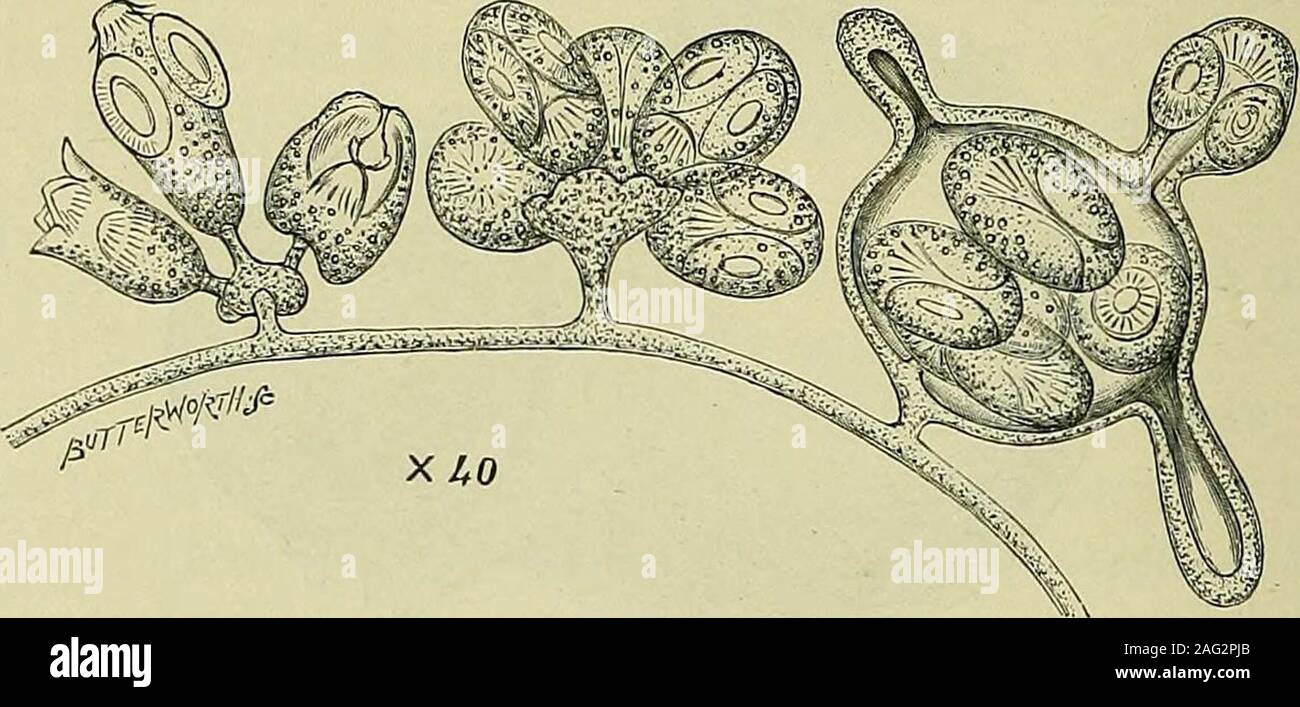 Liver cysts hi-res stock photography and images - Alamy