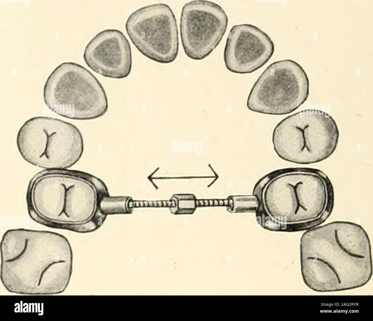 Vulcanite Plates High Resolution Stock Photography and Images - Alamy