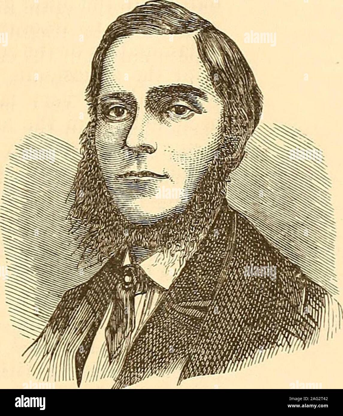 External incision hi-res stock photography and images - Alamy