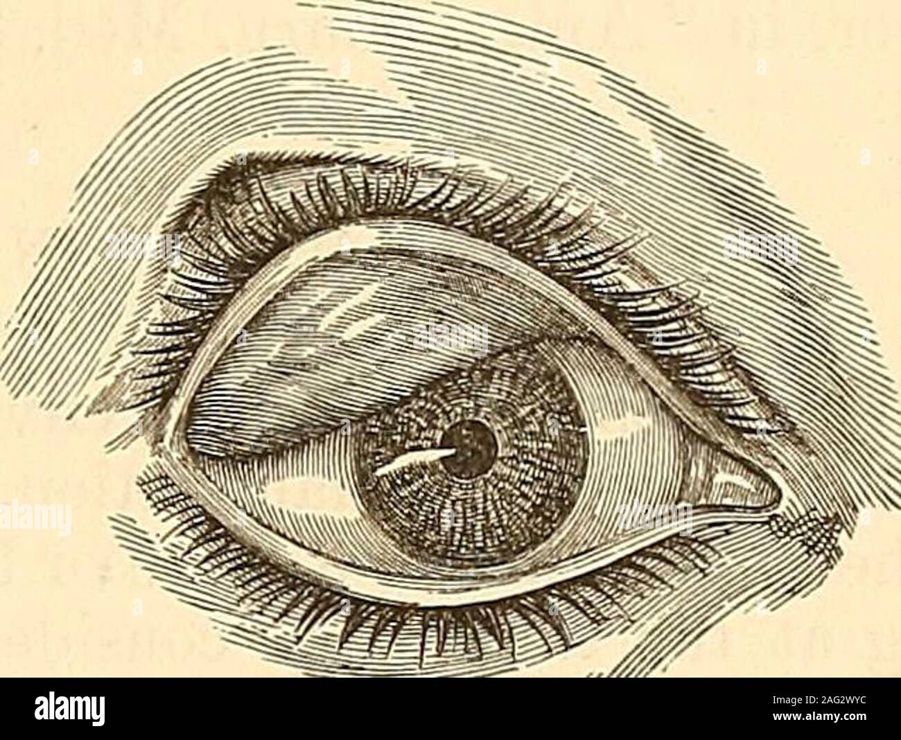 Supervene hi-res stock photography and images - Alamy