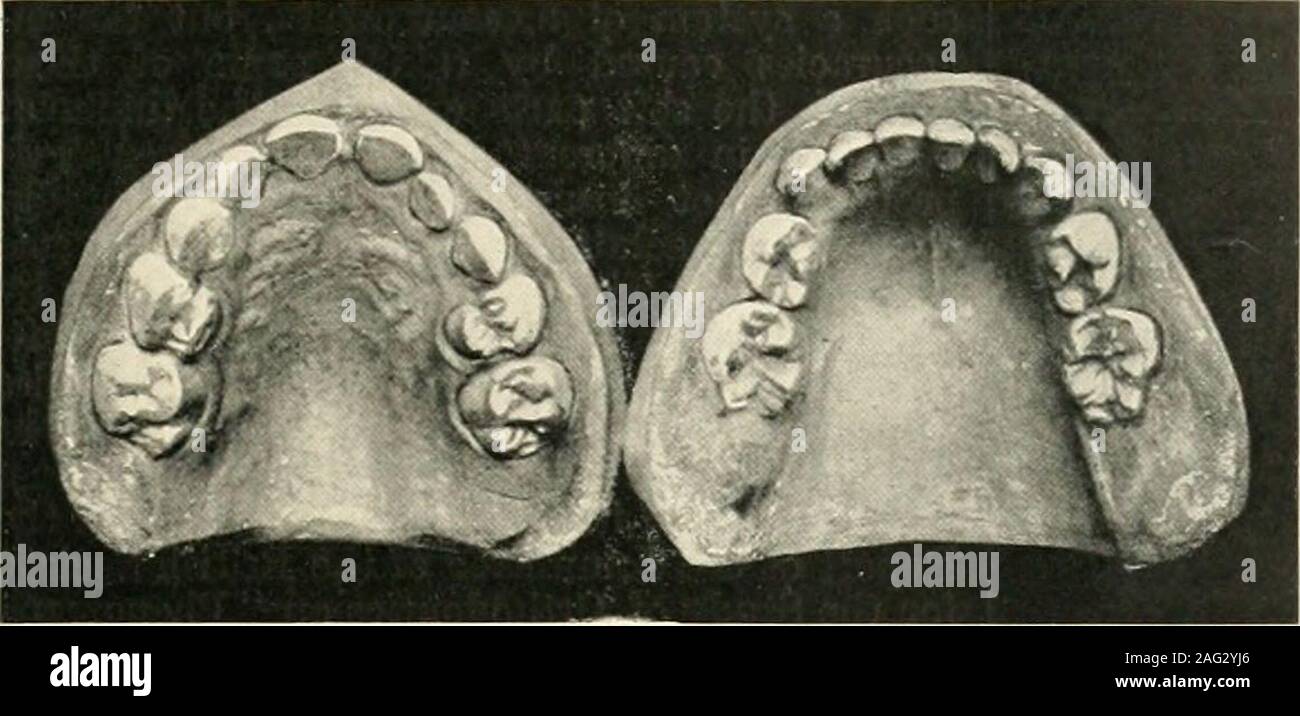 . The science and practice of dental surgery. Fig. 237.—Inferior ...