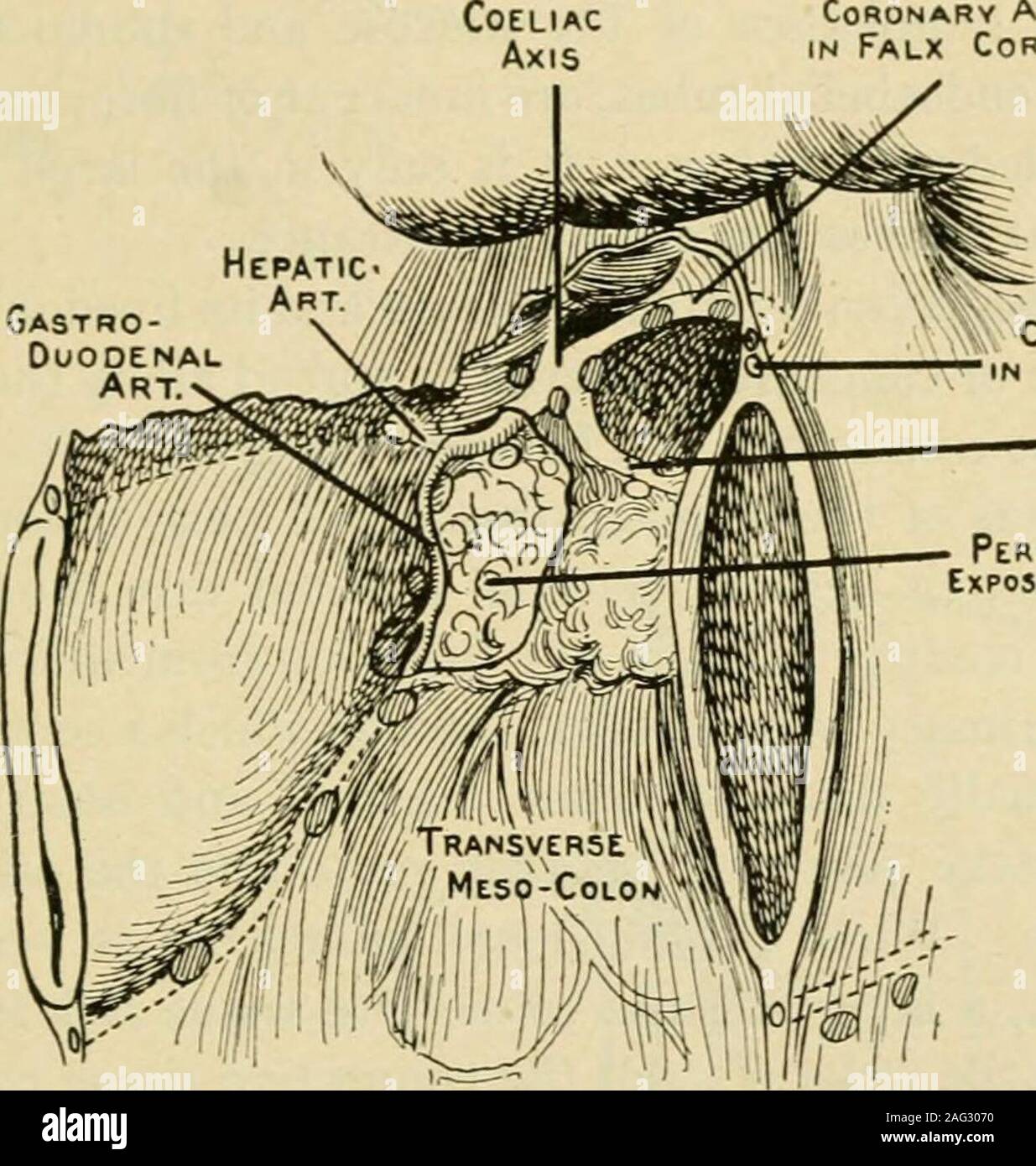 . Manual of operative surgery. ANATOMY 391 cavity (antrum bursae ...