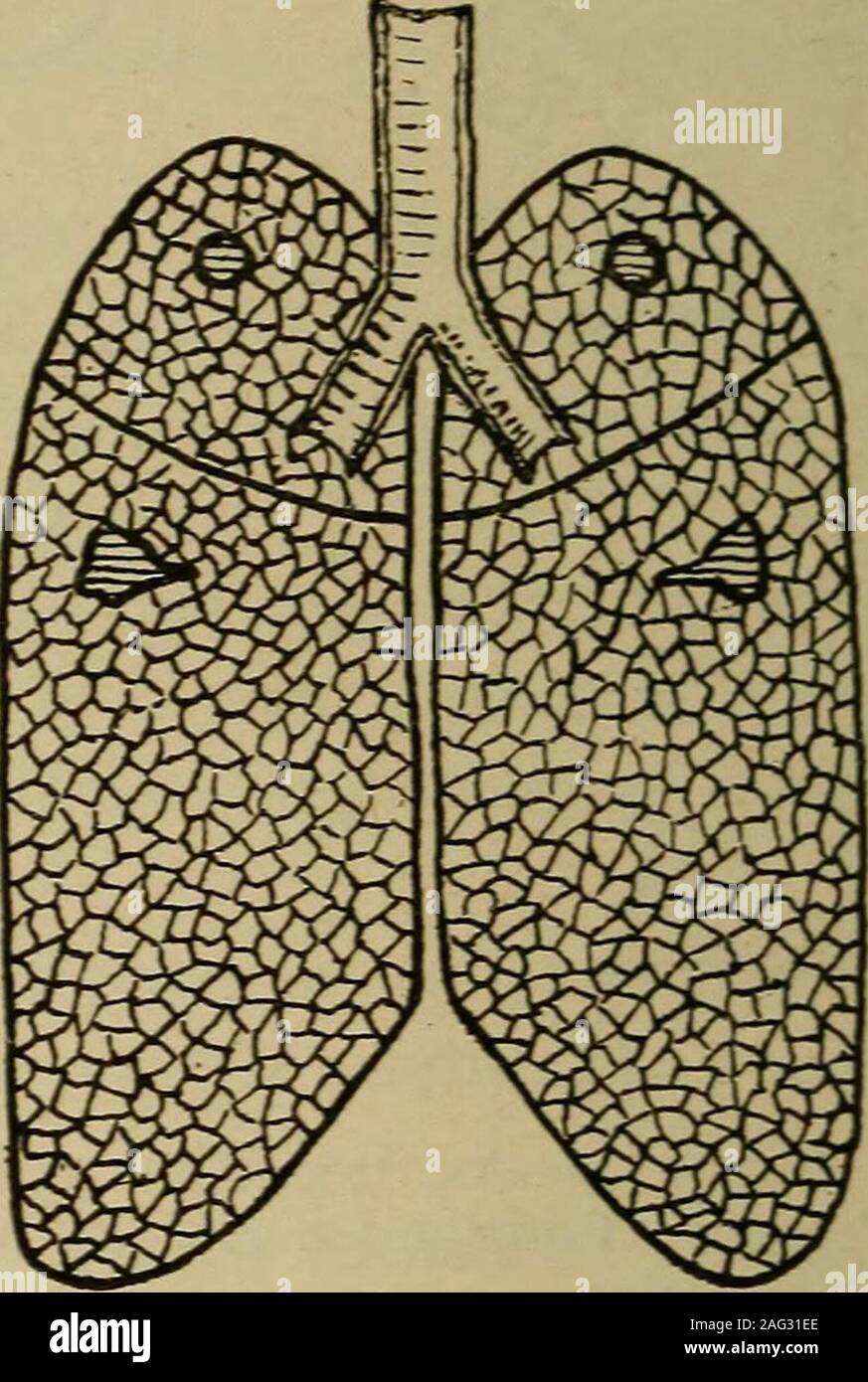 . Medical diagnosis for the student and practitioner. ch scattered foci ...
