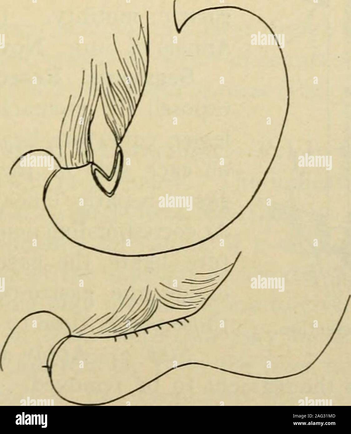 . Manual of operative surgery. Mattress .?ixturr Fig. 520.—{Baljour ...