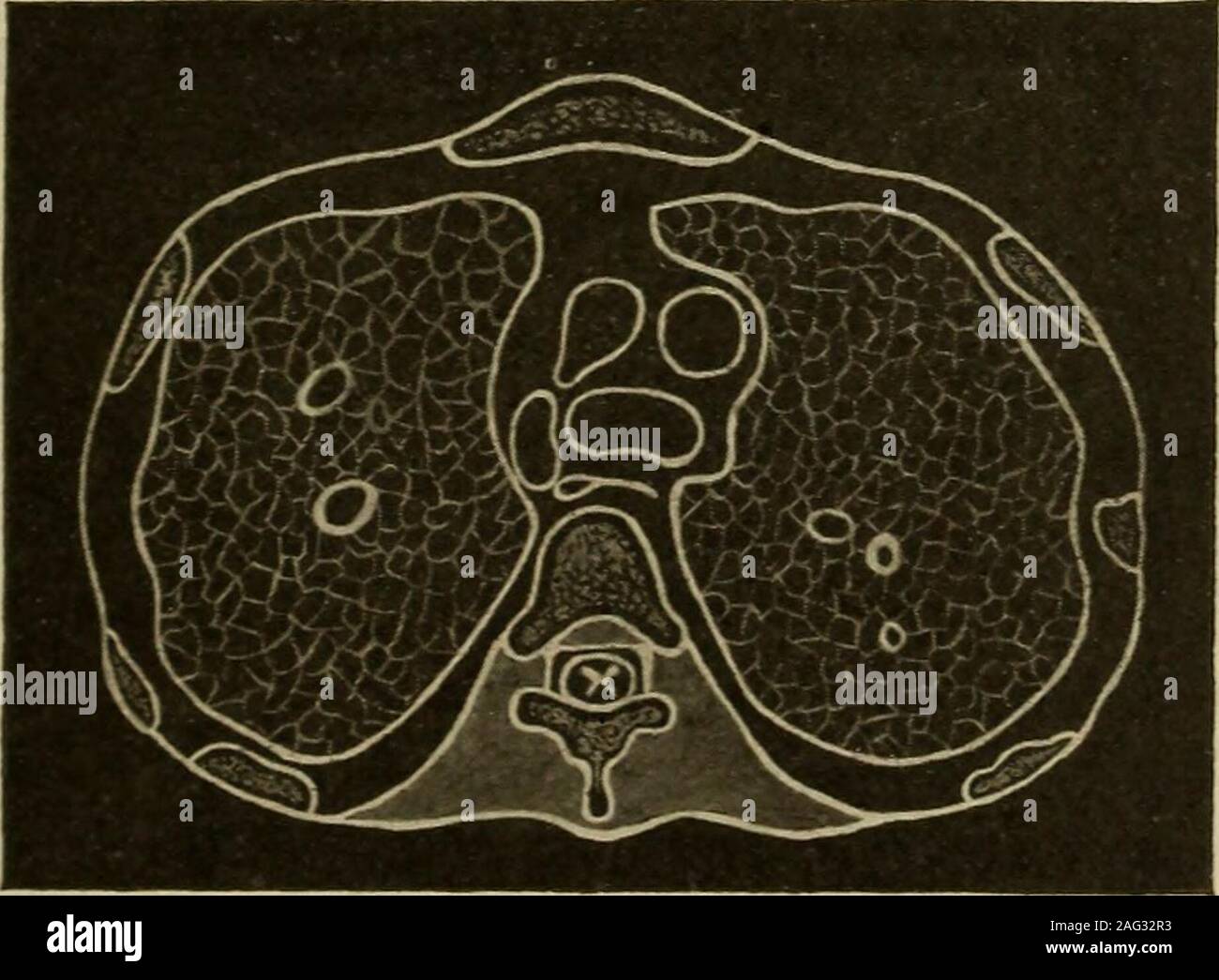 . Medical diagnosis for the student and practitioner. Ostial Resonance ...