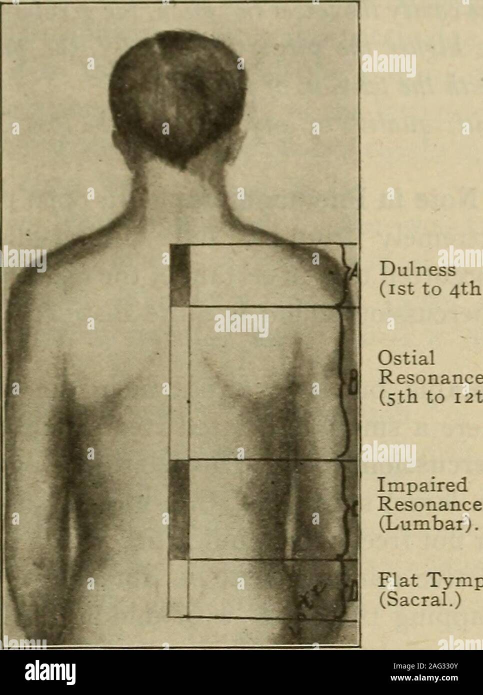 . Medical diagnosis for the student and practitioner. sonance, modified ...