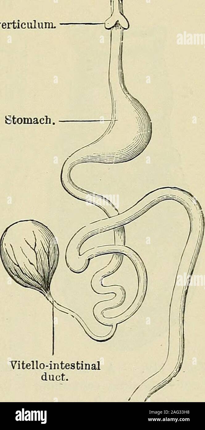 Distension abdominal hi-res stock photography and images - Alamy