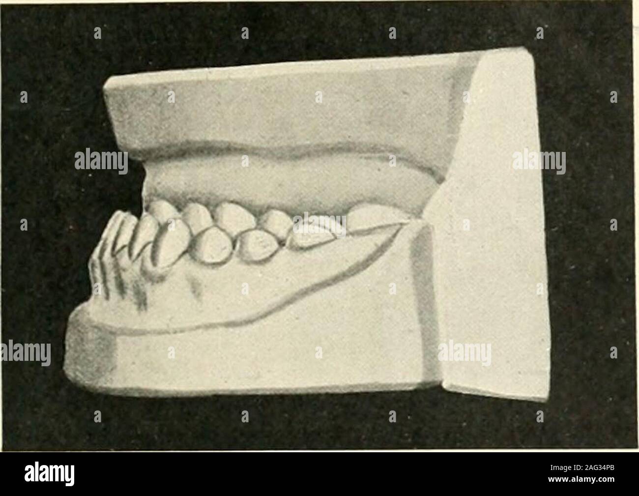 . The science and practice of dental surgery. Fig. 2is.—Inferior ...