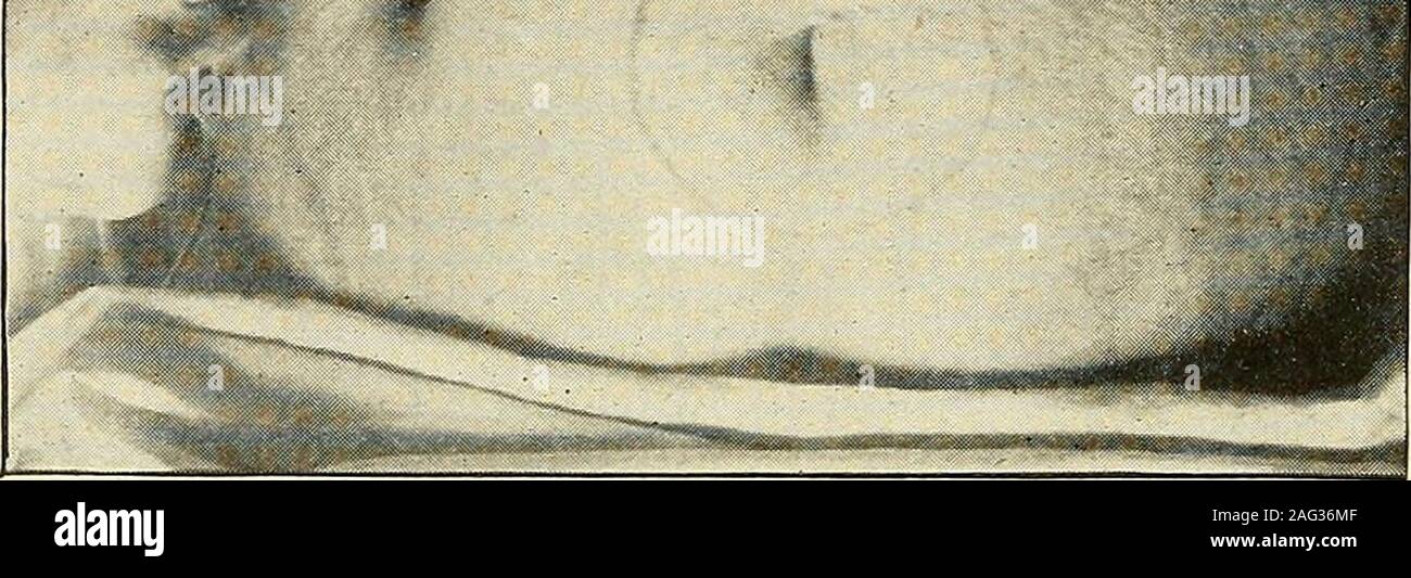 . The diagnosis and treatment of diseases of women. Fig. 161 ...