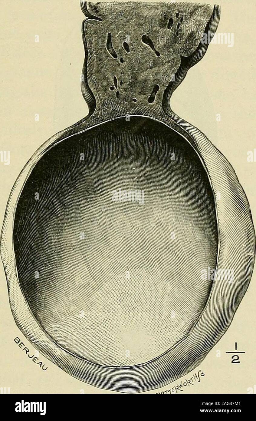 . Tumours, innocent and malignant; their clinical characters and ...