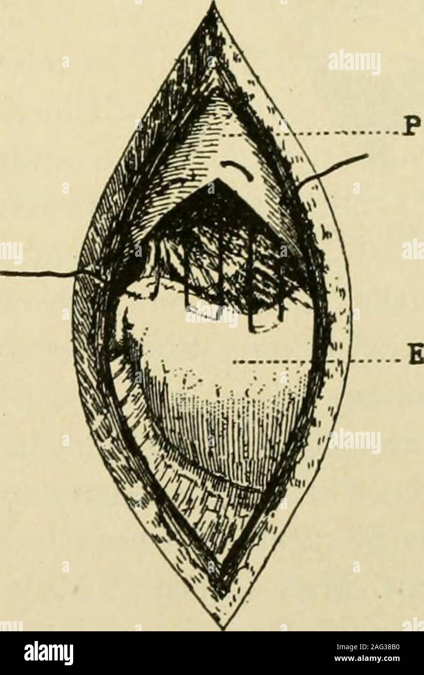 Non normal operation hi-res stock photography and images - Alamy