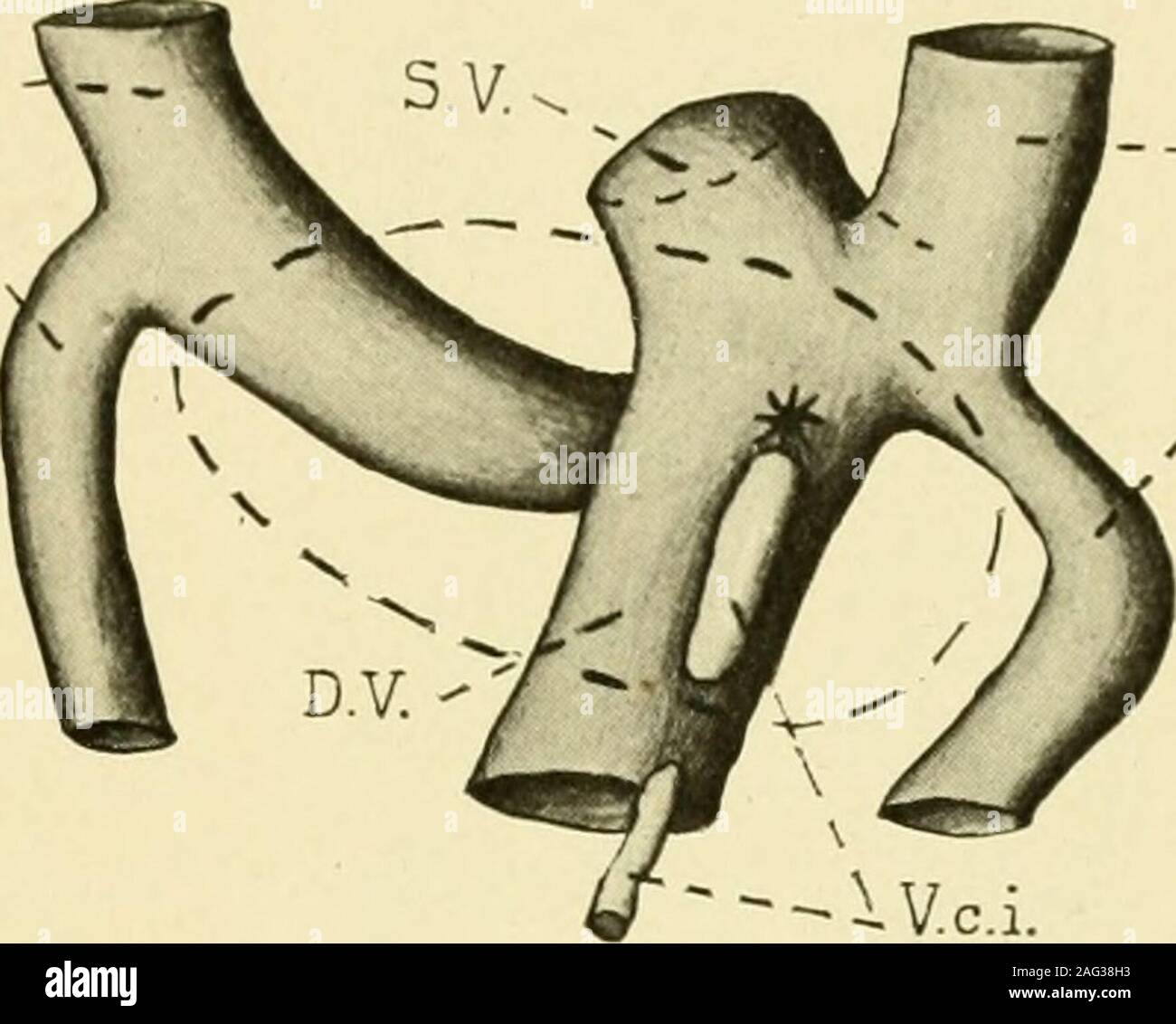 Ductus venosus hi-res stock photography and images - Alamy
