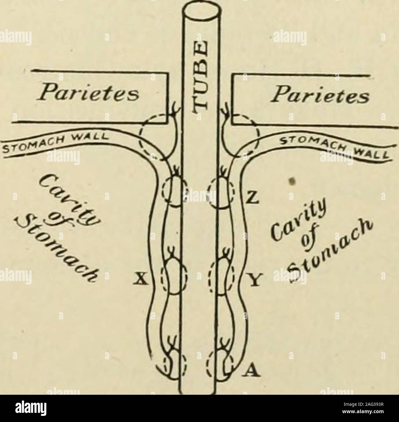 . Manual of operative surgery. Figs. 477 and 478.—Stamm-Kader ...