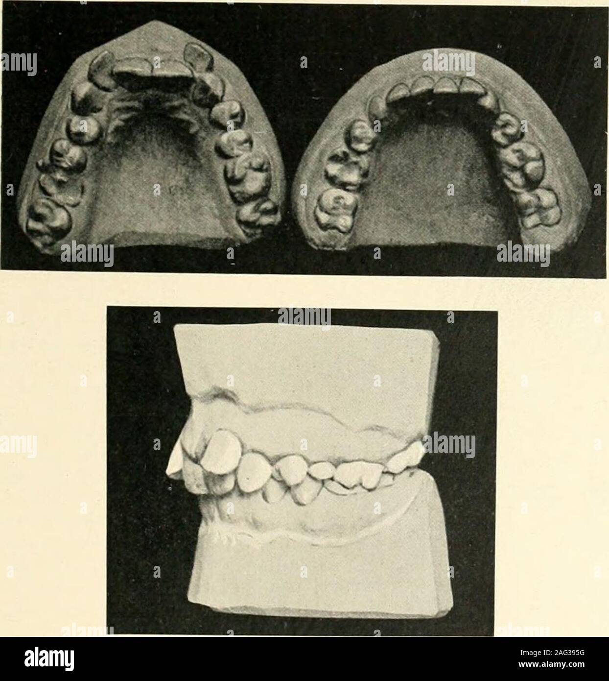 . The science and practice of dental surgery. b IG. 204.—Typical case ...