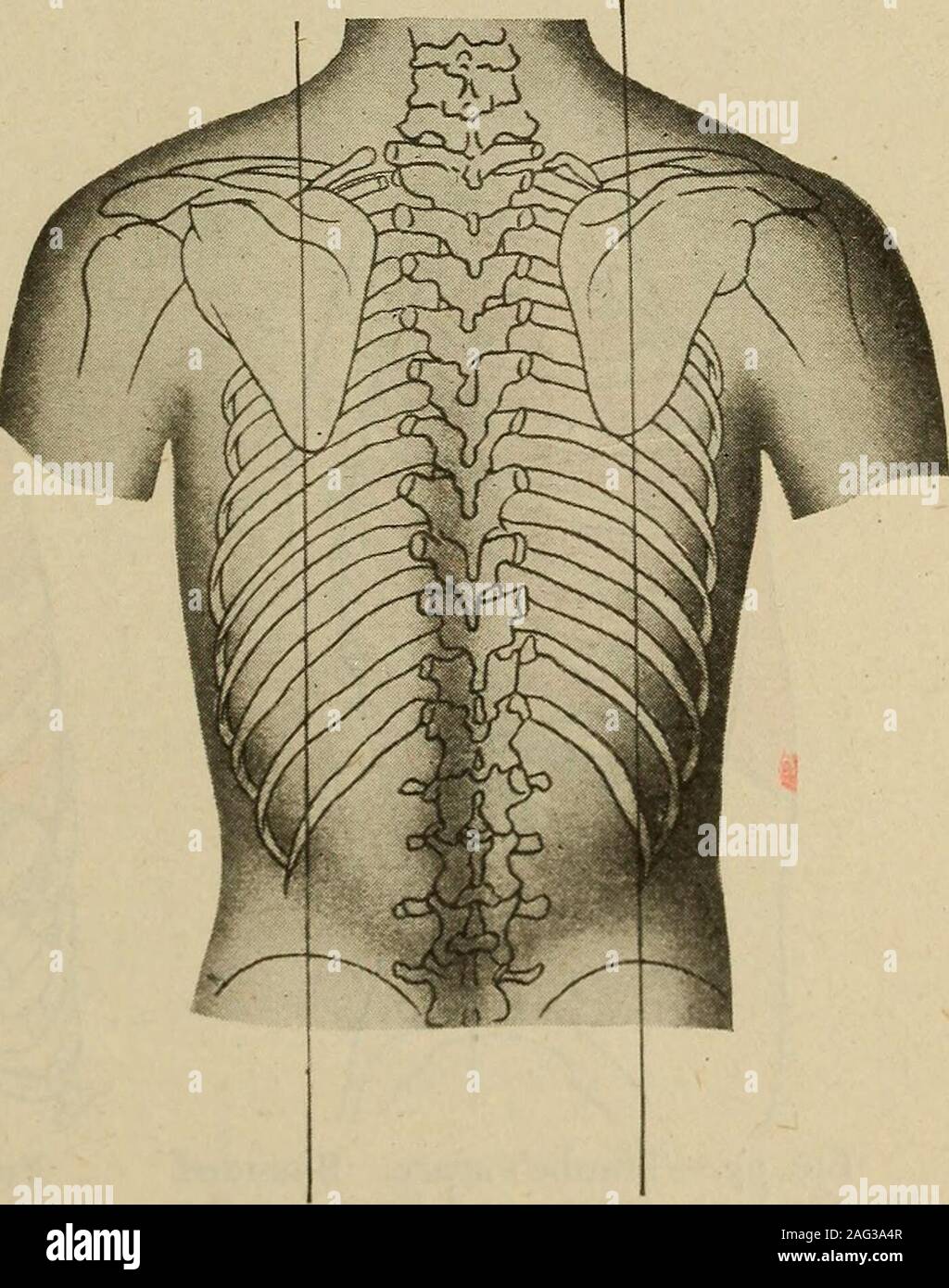 Epigastrium hi-res stock photography and images - Alamy