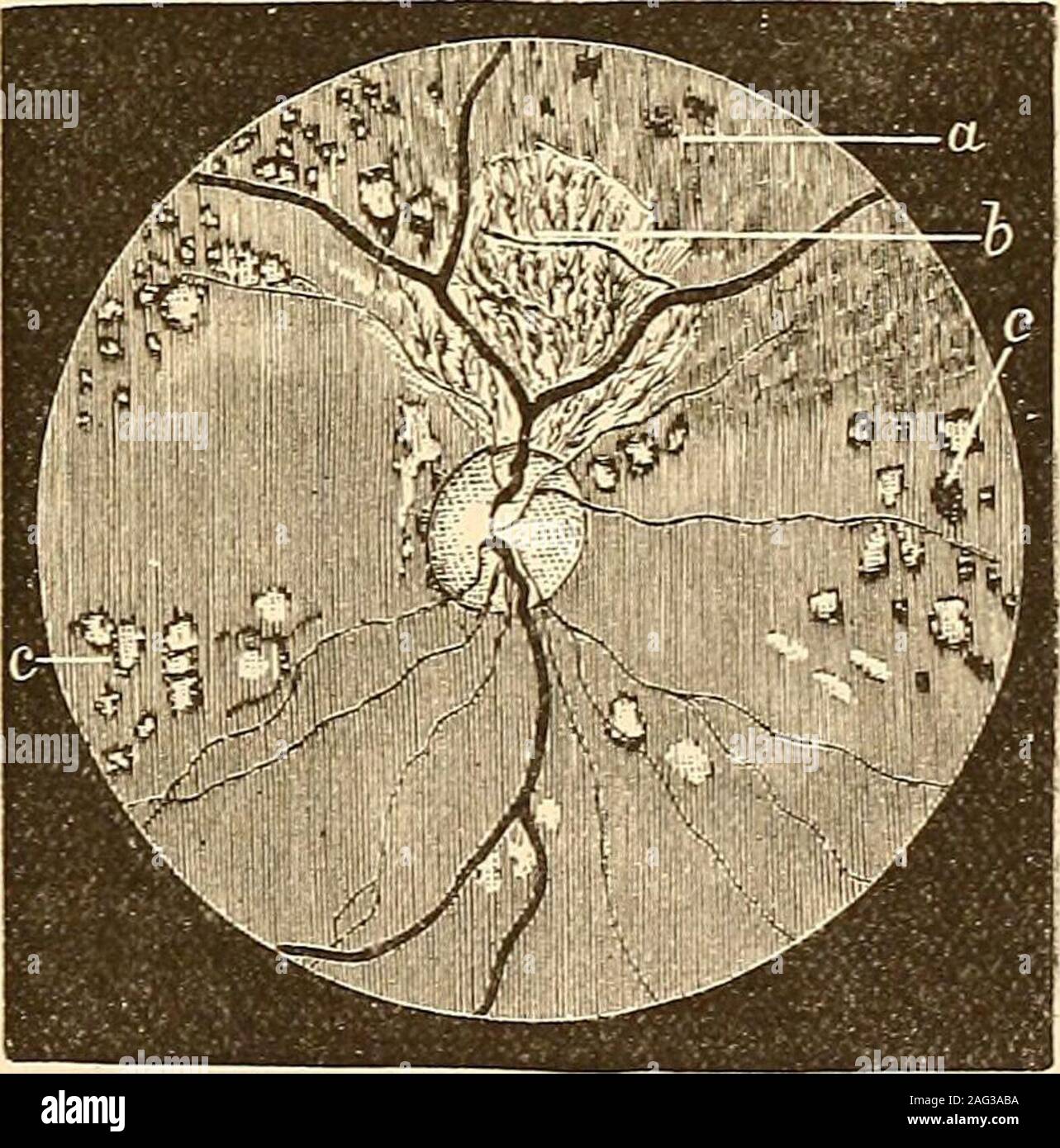 . A treatise on the diseases of the eye. posterior pole of the eye; and ...