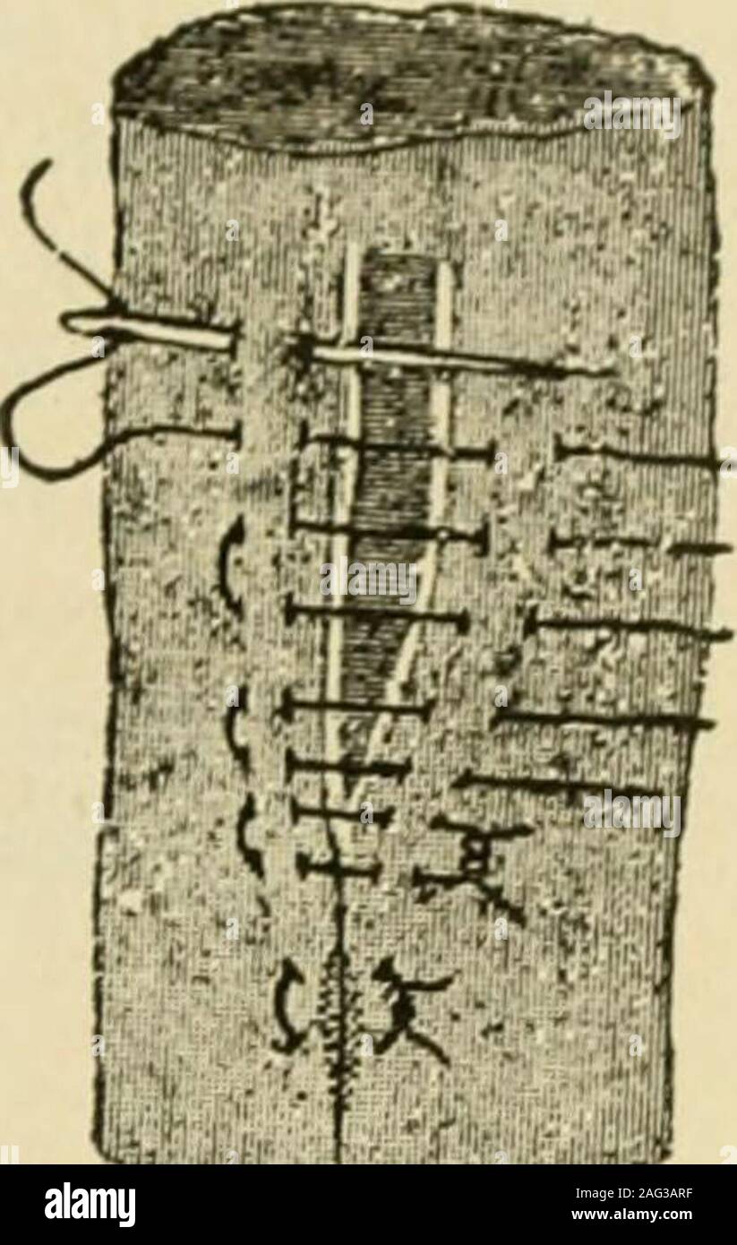 Musculosa hi-res stock photography and images - Alamy