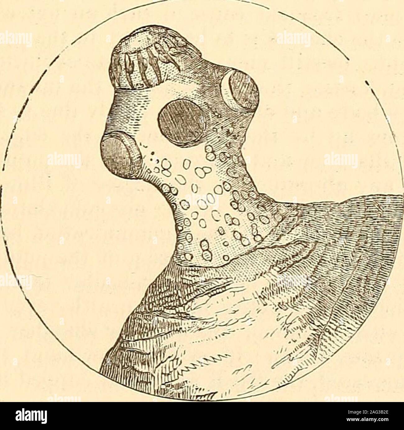 Threadworms hi-res stock photography and images - Alamy