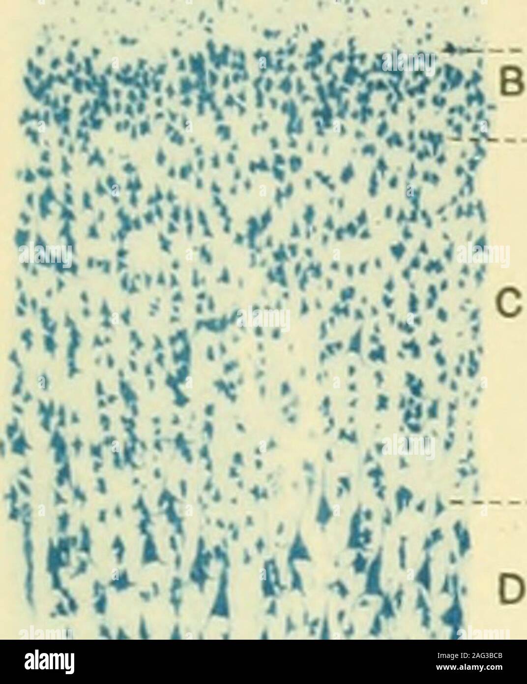 Cortical plate hi-res stock photography and images - Alamy