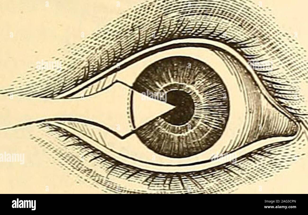 Supervene hi-res stock photography and images - Alamy