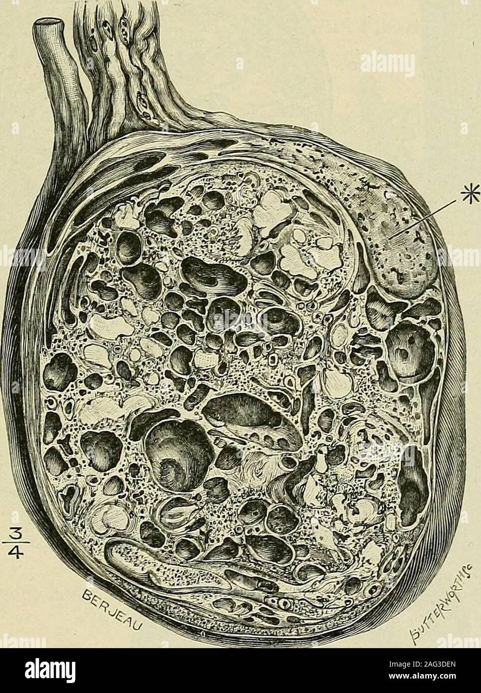 . Tumours, innocent and malignant; their clinical characters and ...