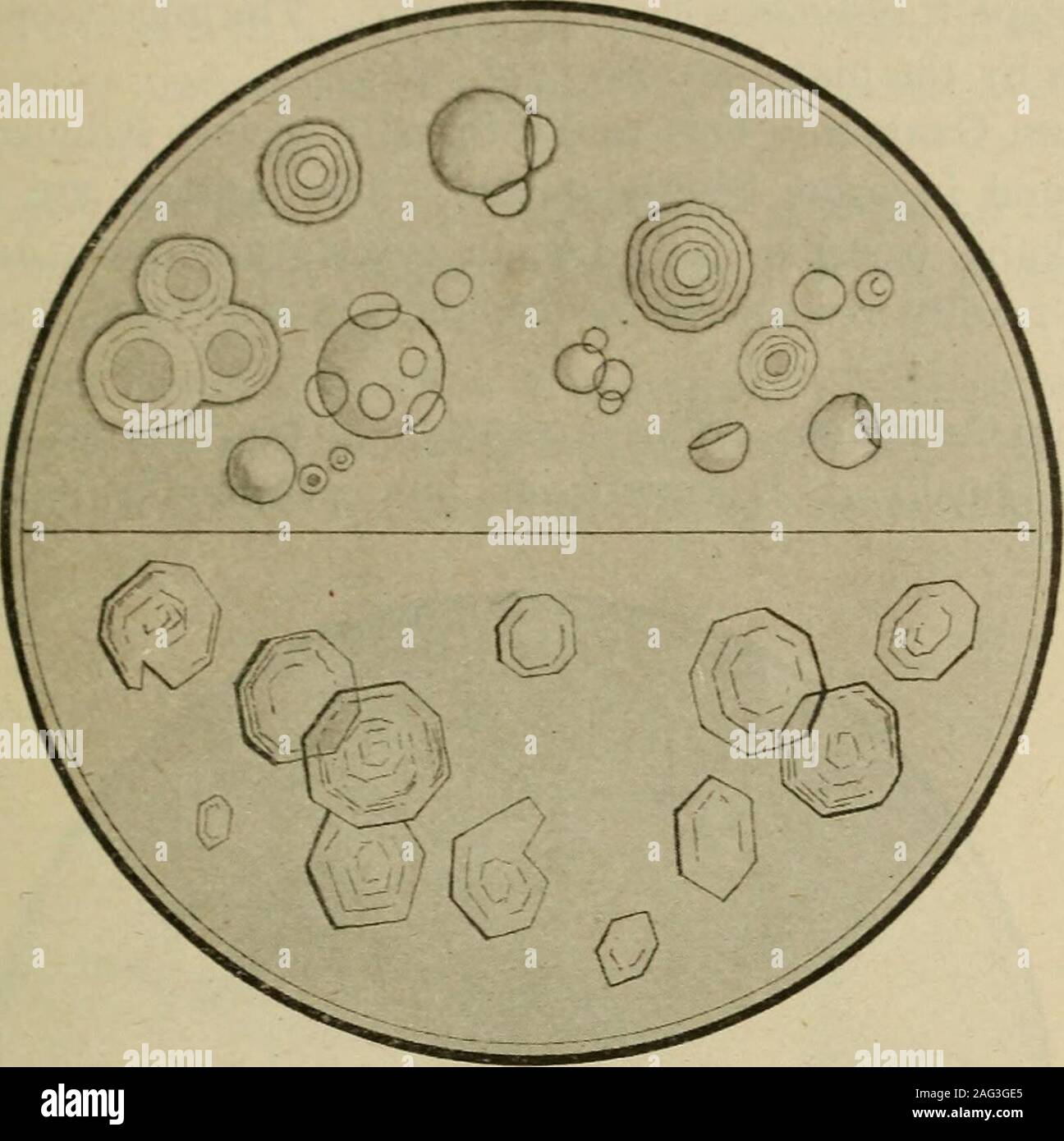 . Medical diagnosis for the student and practitioner. Fig. 72.—Uric ...