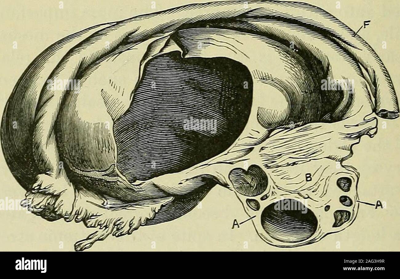 . Tumours, innocent and malignant; their clinical characters and ...