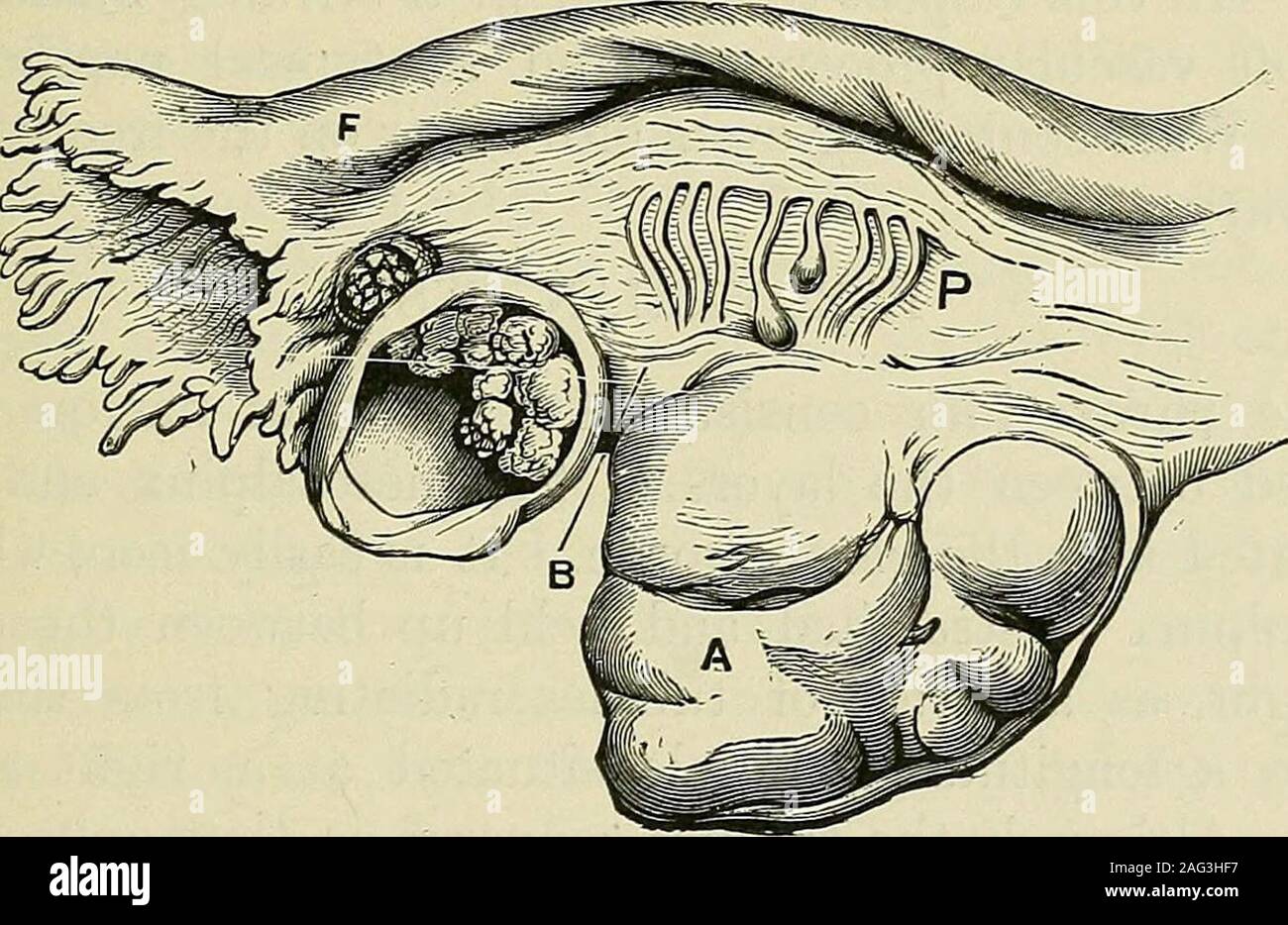 . Tumours, innocent and malignant; their clinical characters and ...
