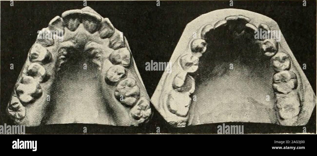 . The science and practice of dental surgery. ionand retrusion to be ...